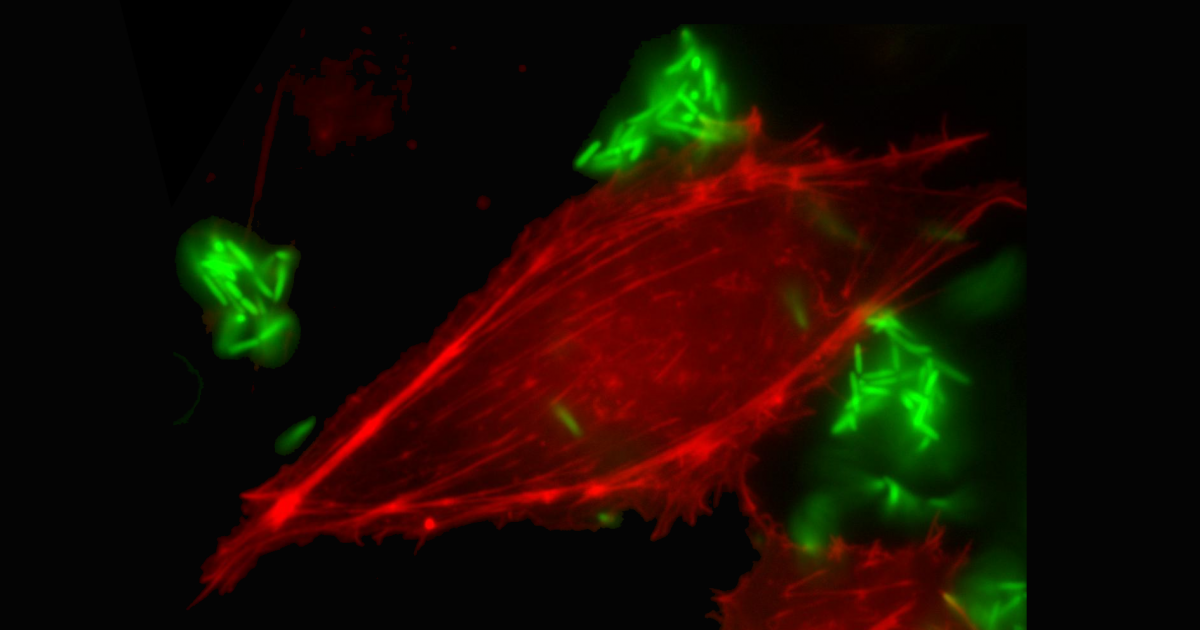Groupe Pathogenèse bactérienne et Réponses Cellulaires (Ina Attree ...
