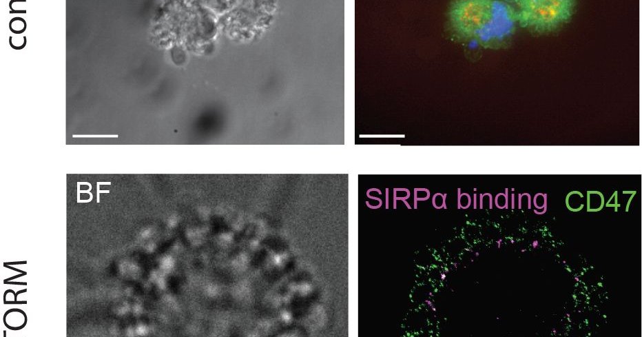 Super-resolution microscopy on the surface of cells in apoptosis ...